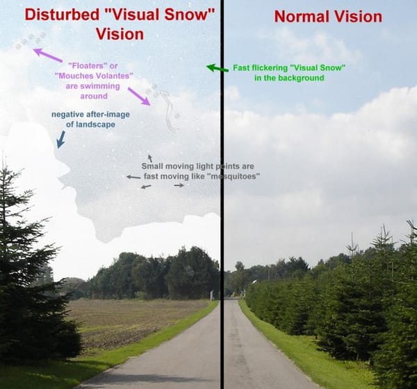 My HPPD and Visual Snow Syndrome experience.